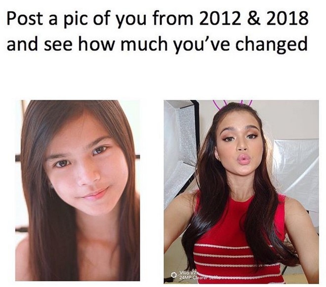 Celebrities’ surprising then and now photos | PUSH.COM.PH: Your ...