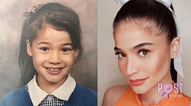 LOOK: Adorable Anne Curtis during pre-school days | PUSH.COM.PH: Your ...